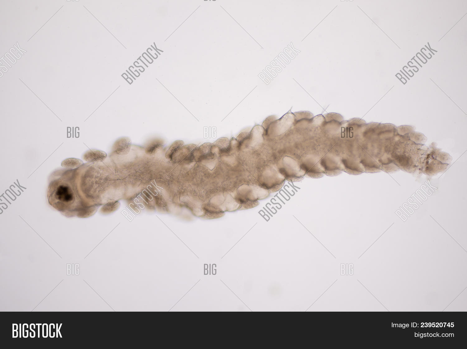 Tapeworm Under Microscope