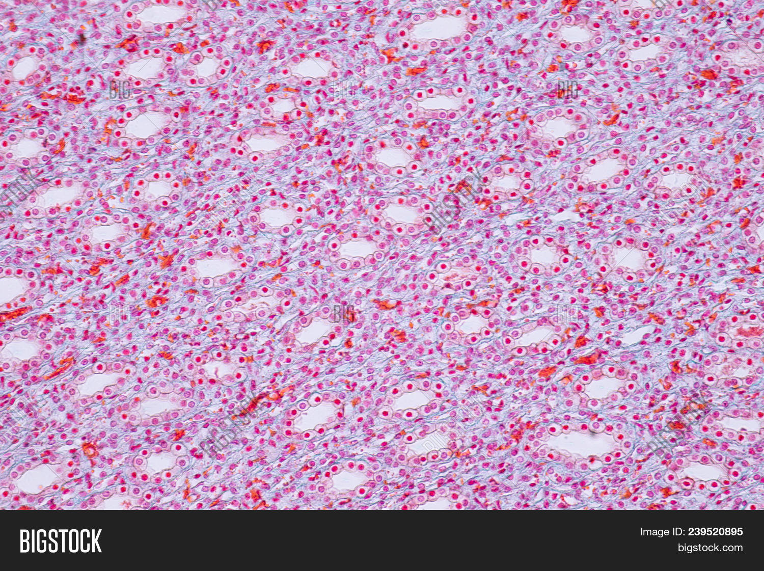 Histology Human Kidney Image & Photo (Free Trial) | Bigstock