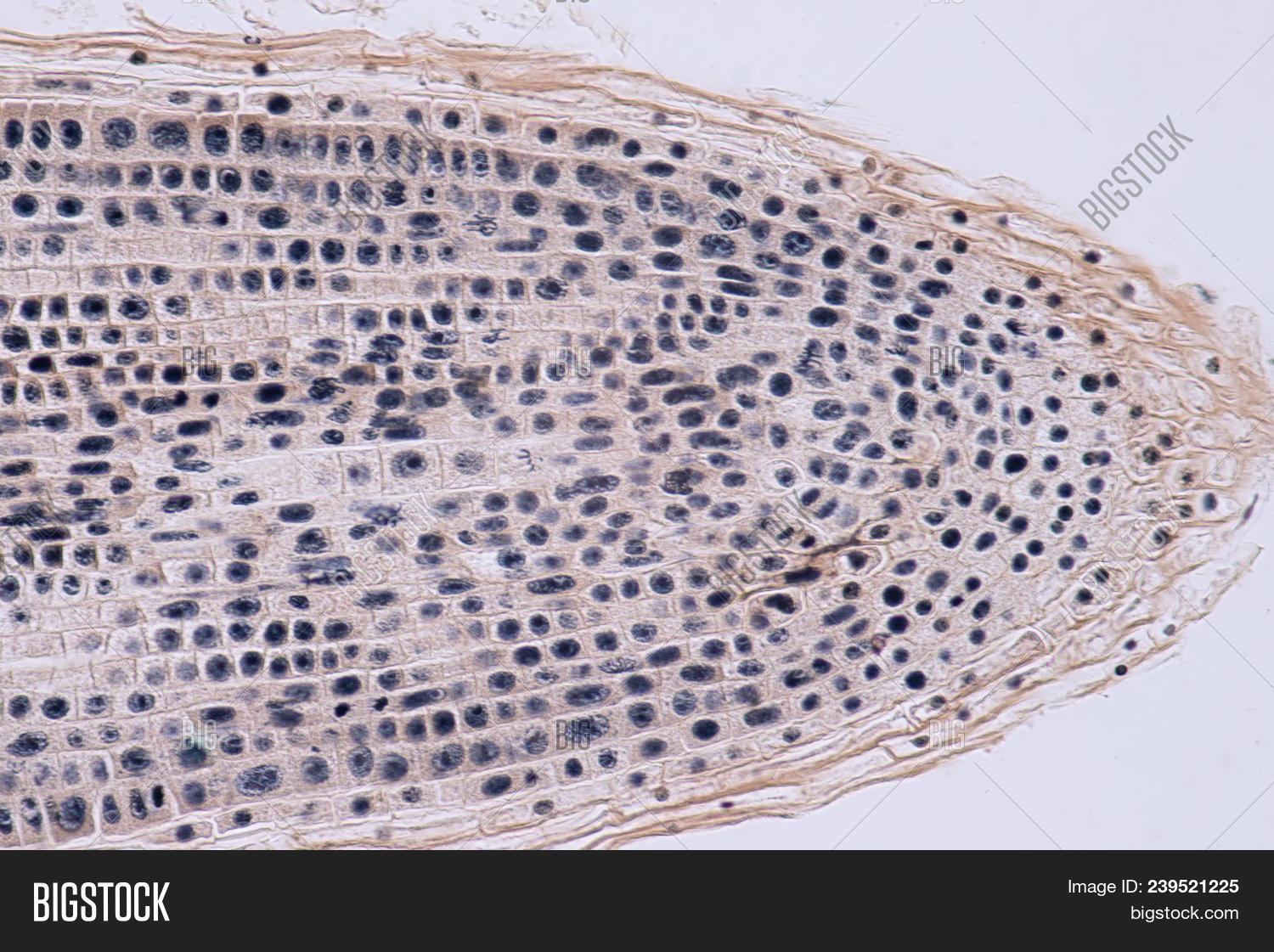 Root Tip Onion Mitosis Image & Photo (Free Trial) | Bigstock