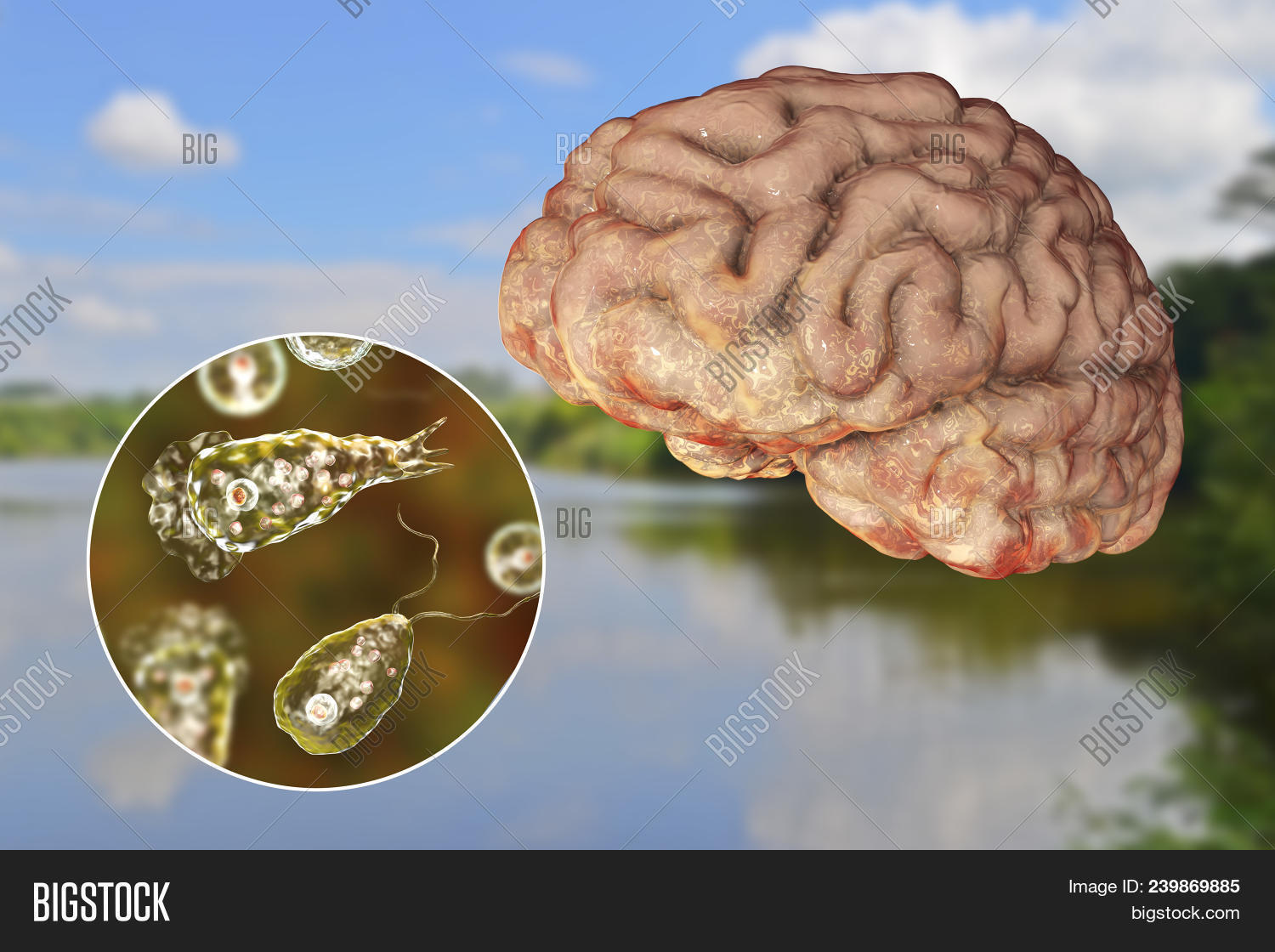 Brain-eating Amoeba Image & Photo (Free Trial) | Bigstock