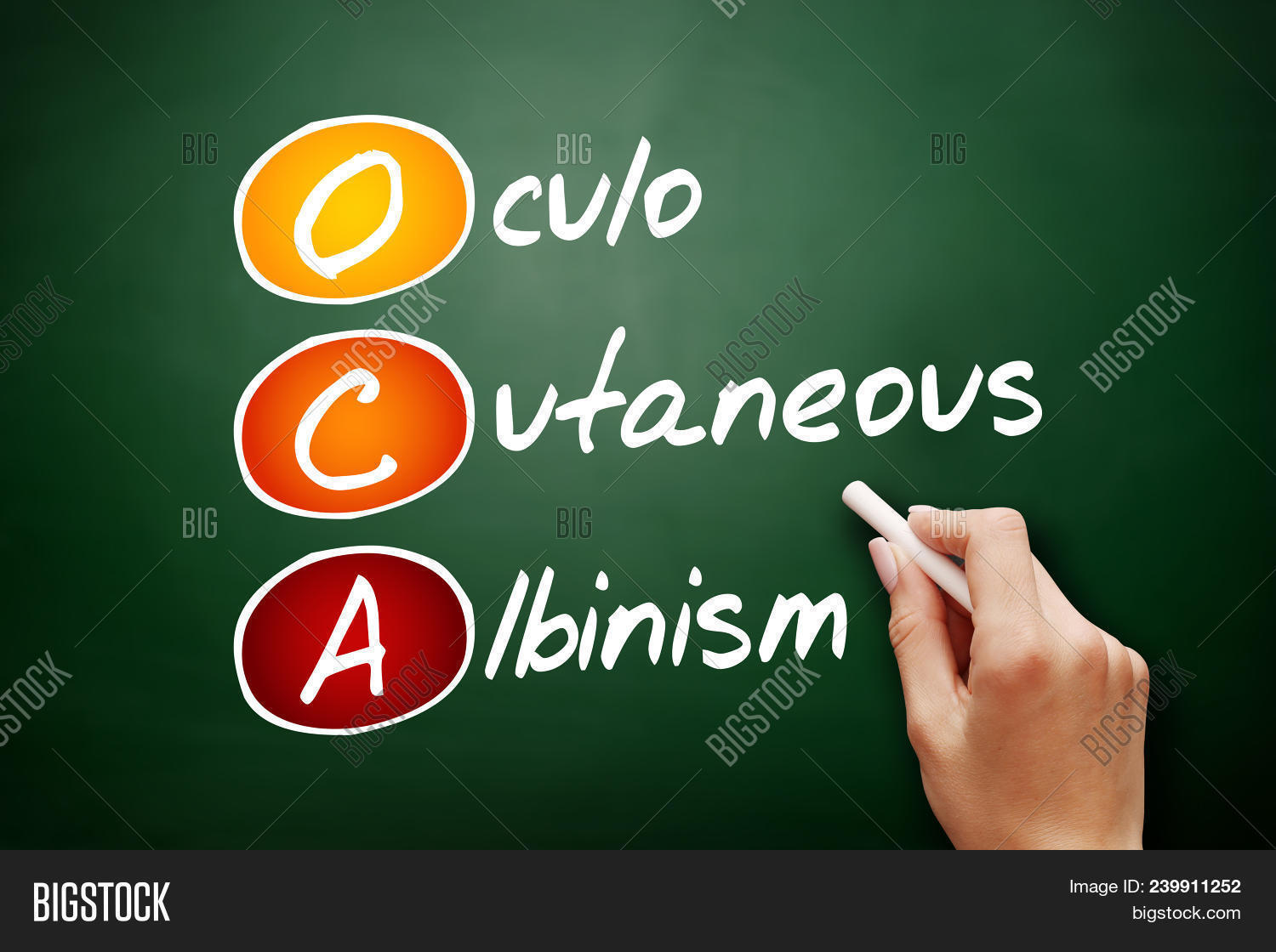 Oca - Oculo Cutaneous Image & Photo (Free Trial) | Bigstock