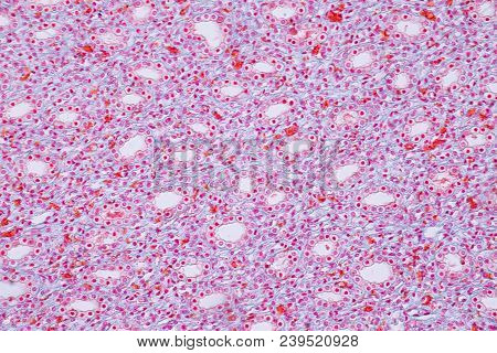 Histology Human Kidney Image & Photo (Free Trial) | Bigstock