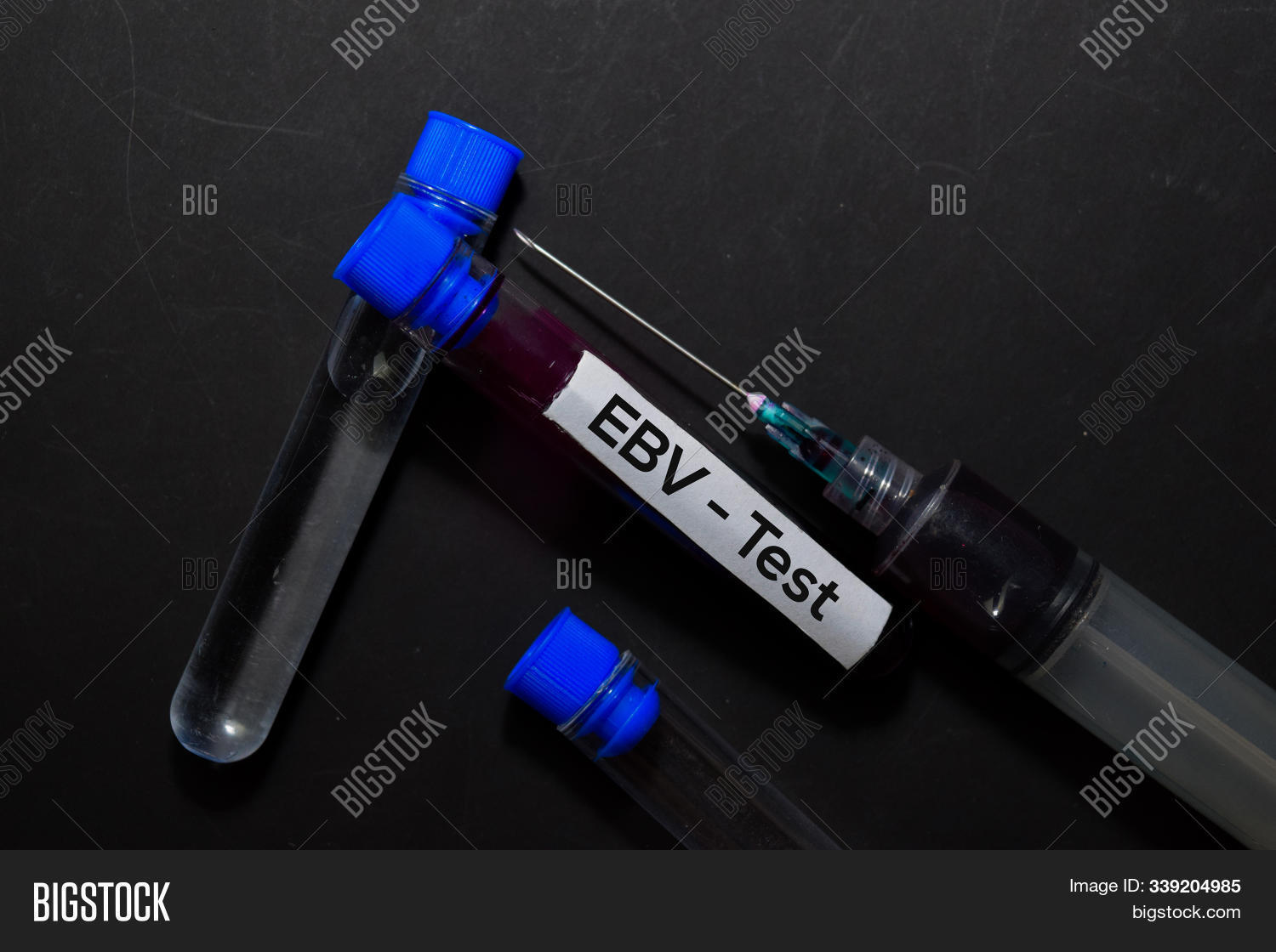 Ebv - Test Blood Image & Photo (Free Trial) | Bigstock