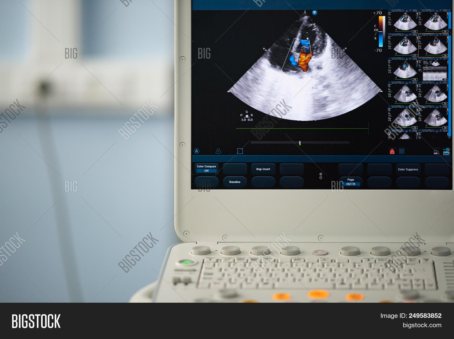 On Screen Ultrasound Image & Photo (Free Trial) | Bigstock