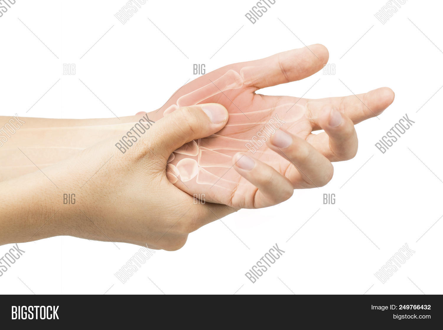 Hand Bone Pain White Image & Photo (Free Trial) | Bigstock