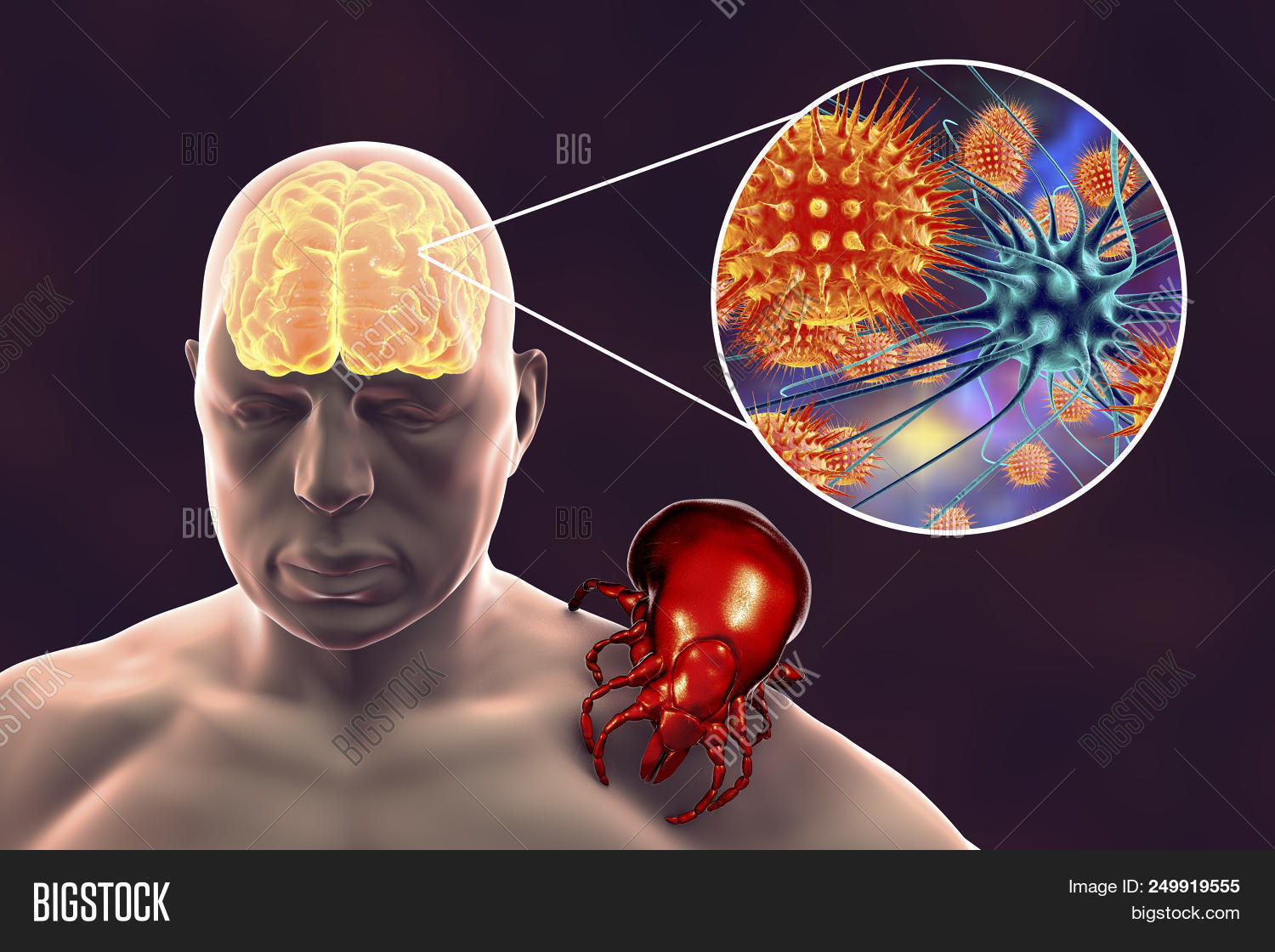 Tick-borne Image & Photo (Free Trial) | Bigstock