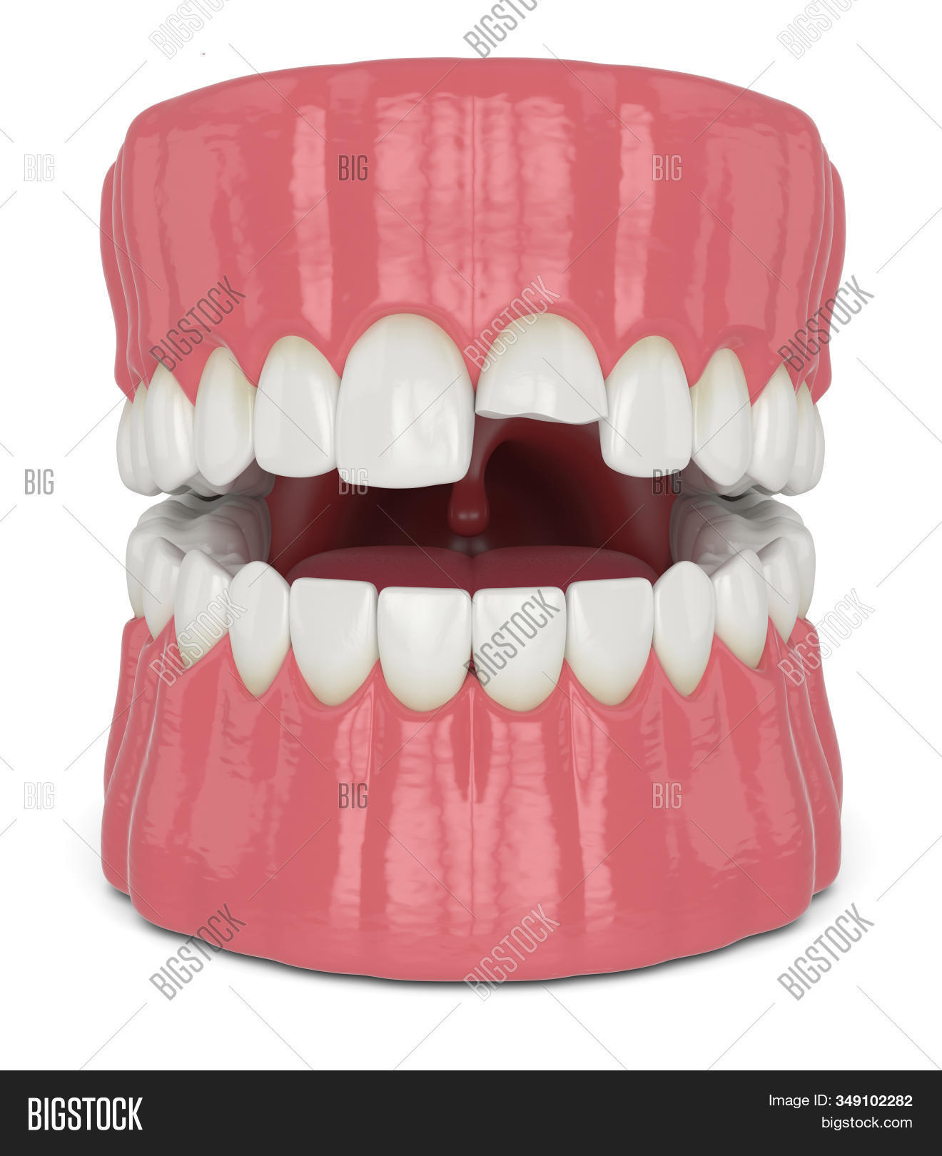 3d Render Opened Jaw Image & Photo (Free Trial) | Bigstock