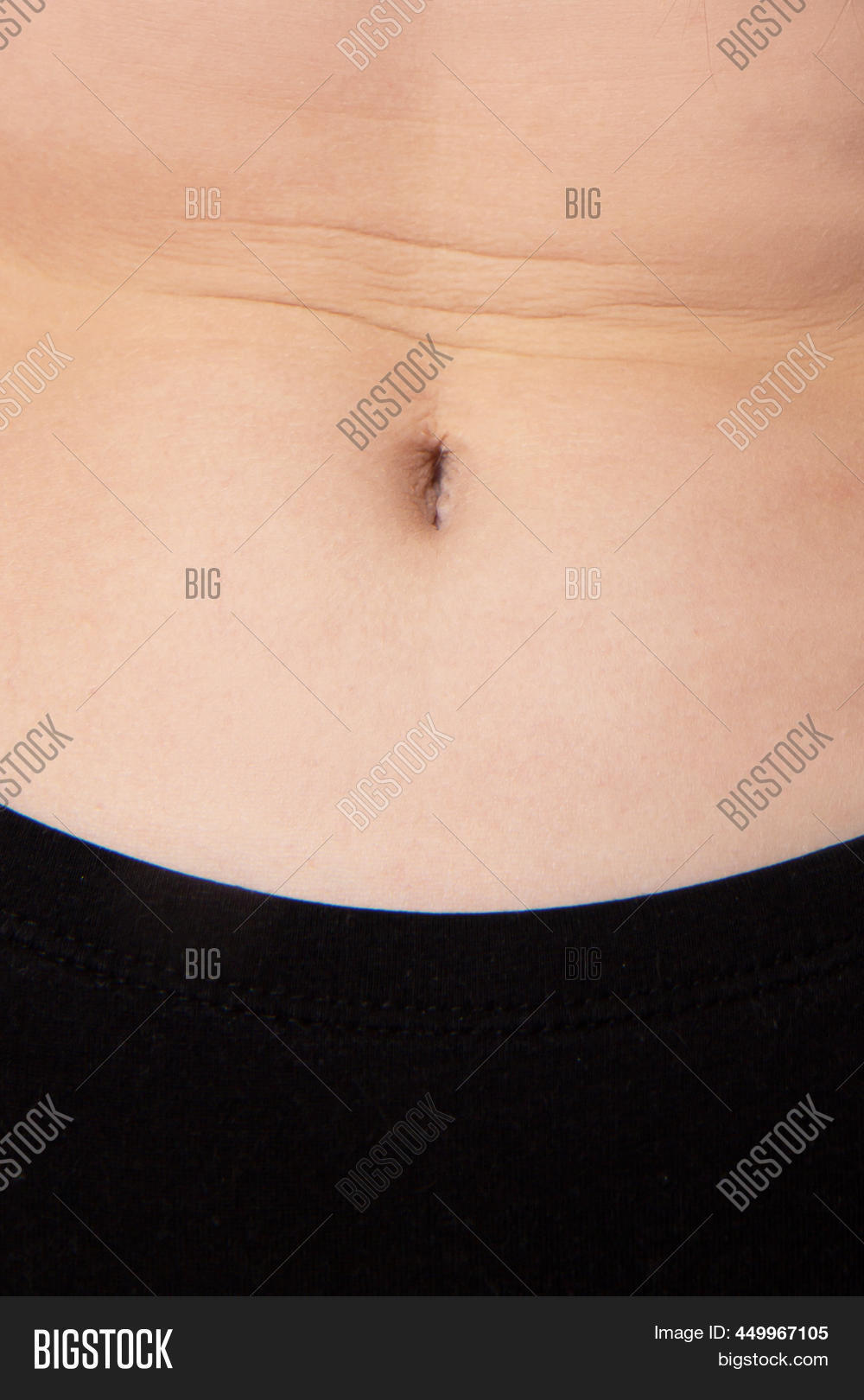 Woman Belly Folds. Image & Photo (Free Trial) | Bigstock