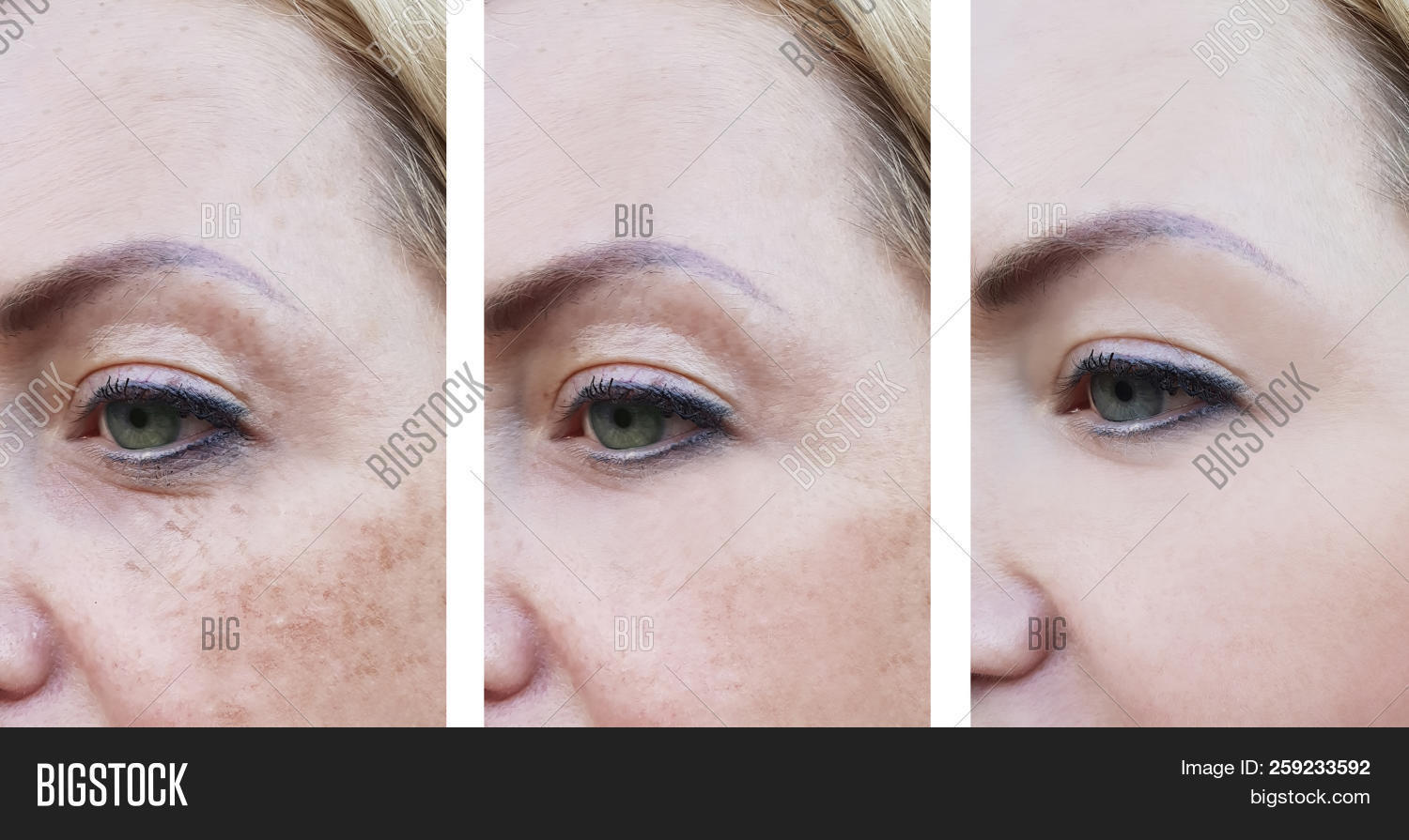 Woman Wrinkles On Face Image & Photo (Free Trial) | Bigstock