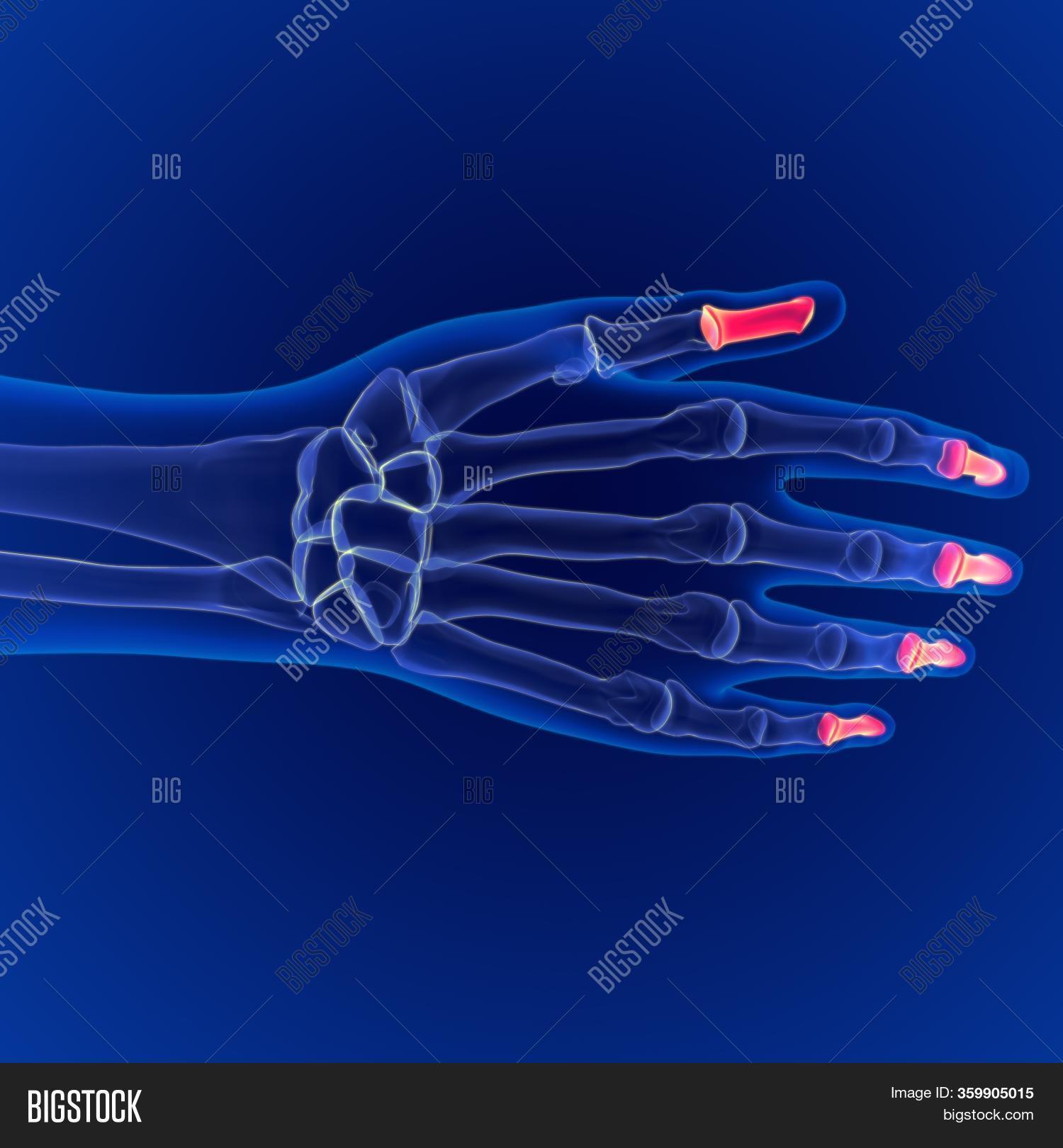 Human Skeleton Anatomy Image & Photo (Free Trial) | Bigstock