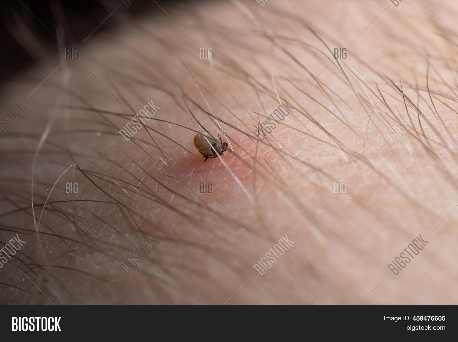 Sucking Tick Macro Image & Photo (Free Trial) | Bigstock