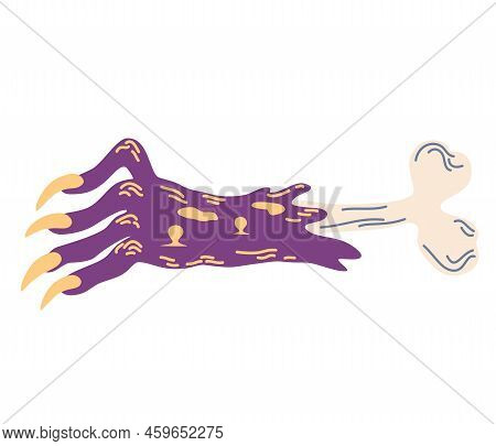 Hand Protruding Bone Vector & Photo (Free Trial) | Bigstock