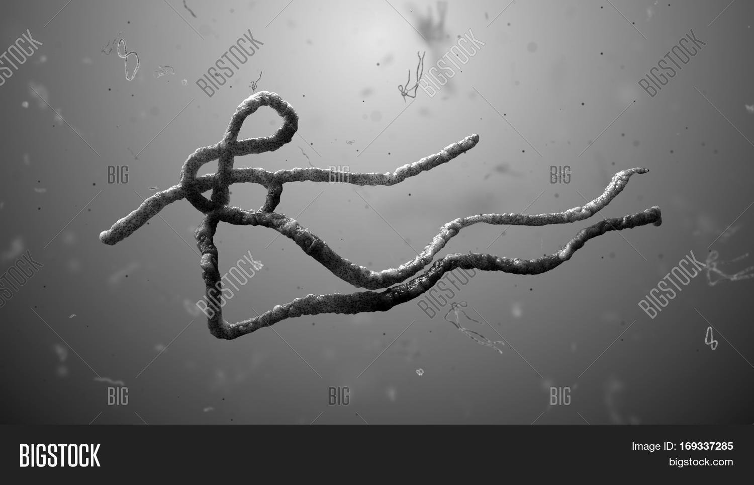 Ascaris Lumbricoides, Image & Photo (Free Trial) | Bigstock