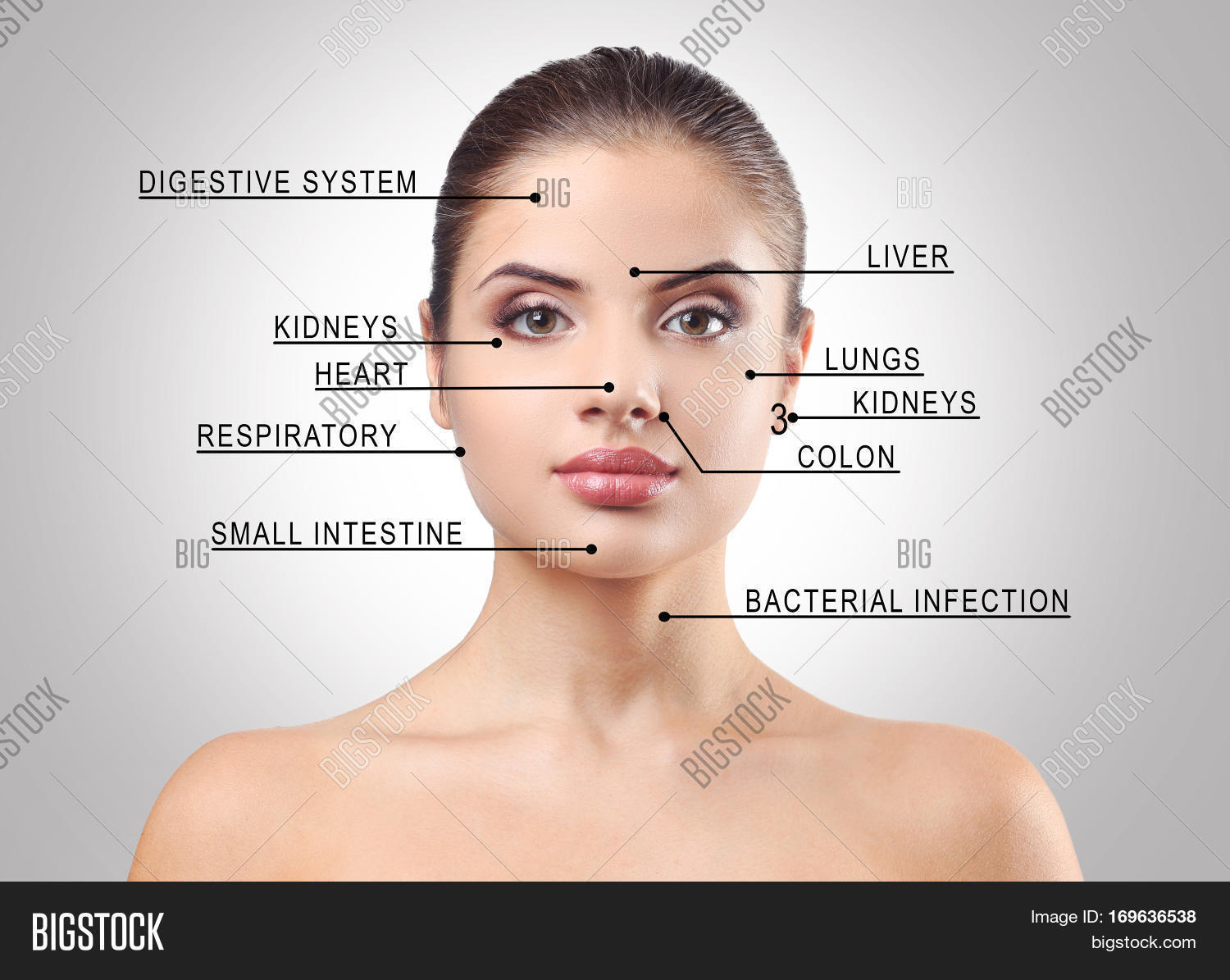 Pimples On Face Diagram