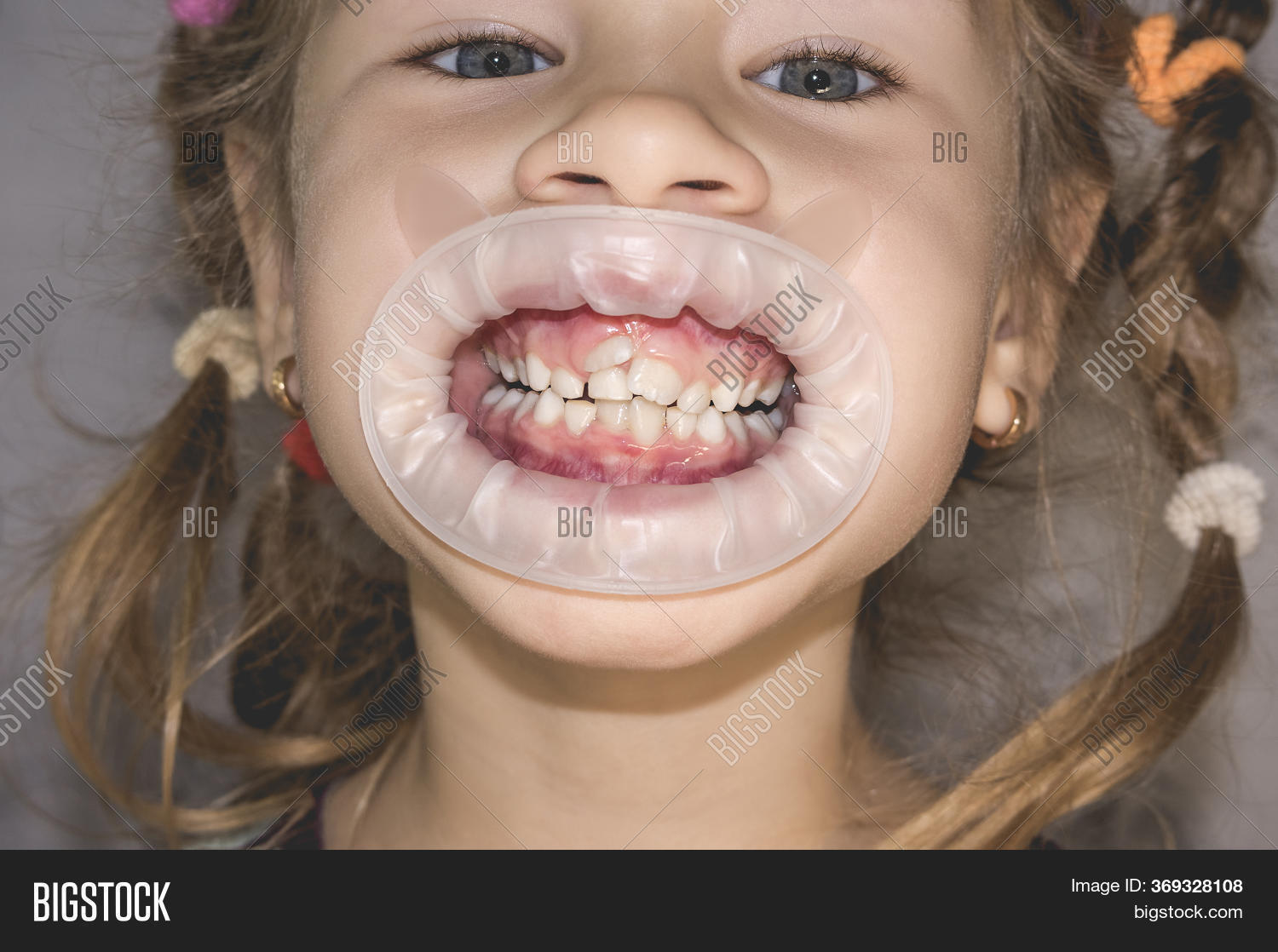 Adult Permanent Teeth Image & Photo (Free Trial) | Bigstock