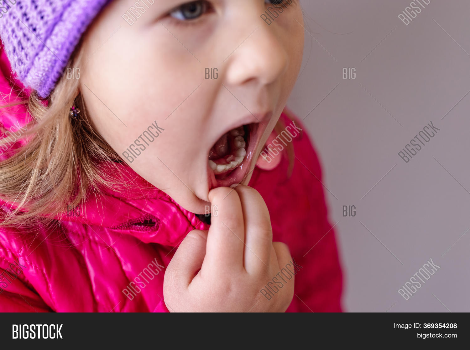 Adult Permanent Teeth Image & Photo (Free Trial) | Bigstock