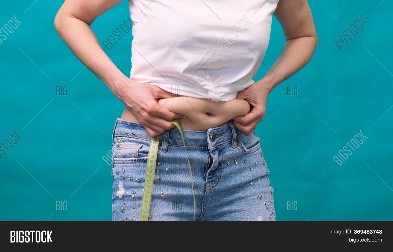 Woman Holds Fold Skin Image & Photo (Free Trial) | Bigstock