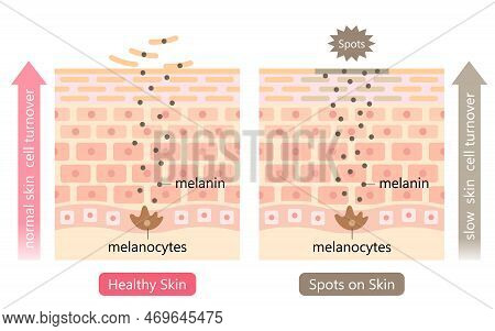 Skin Cell Turnover Image & Photo (Free Trial) | Bigstock