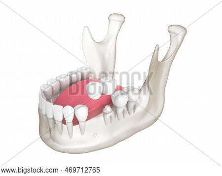 3d Render Mandible Image & Photo (Free Trial) | Bigstock