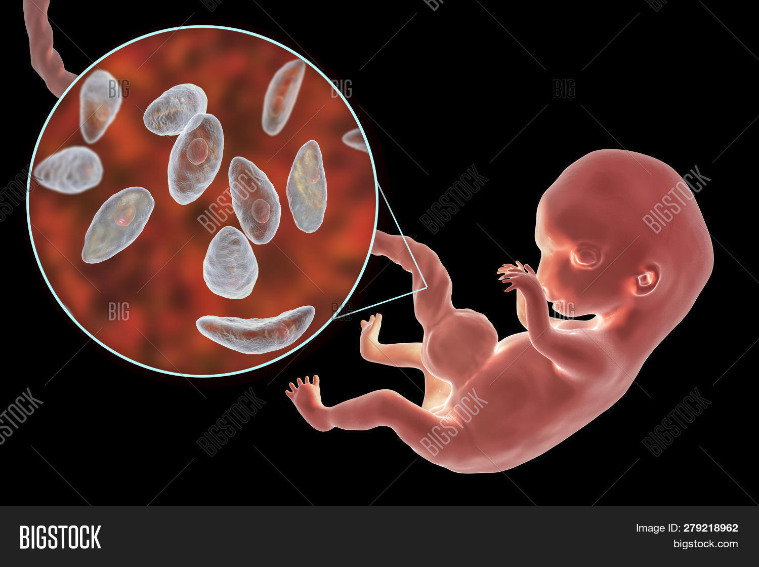 Transplacental Image & Photo (Free Trial) | Bigstock