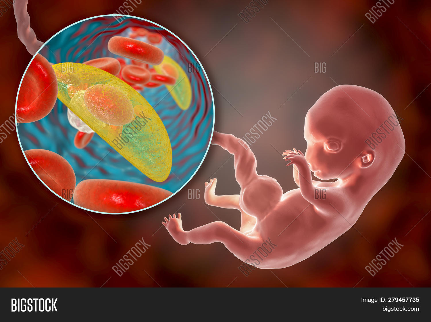 Transplacental Image & Photo (Free Trial) | Bigstock