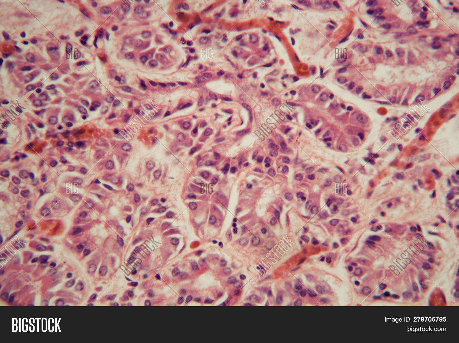 Human Lung Tissue Image & Photo (Free Trial) | Bigstock