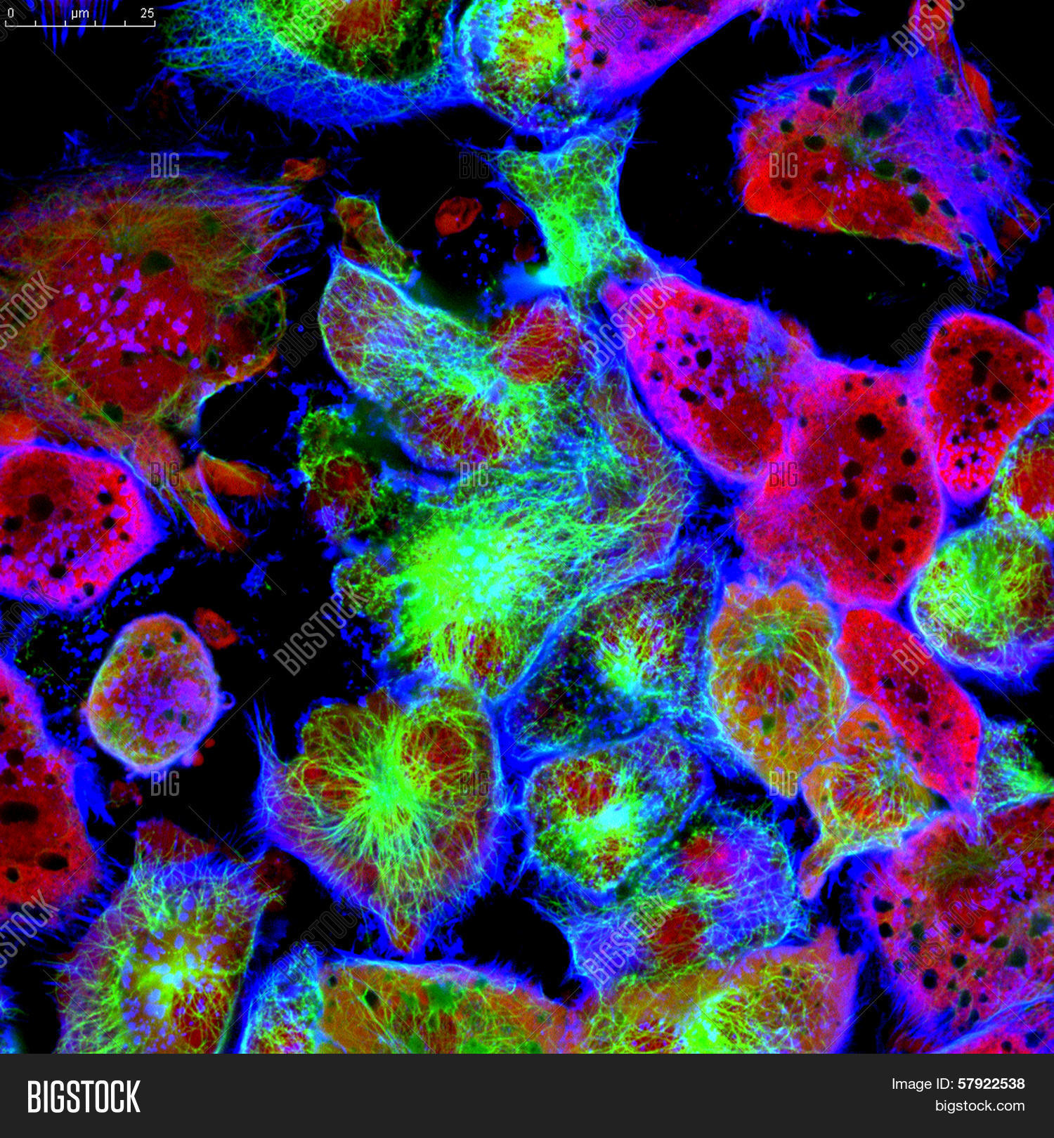 Tumor Cells Under Image & Photo (Free Trial) | Bigstock