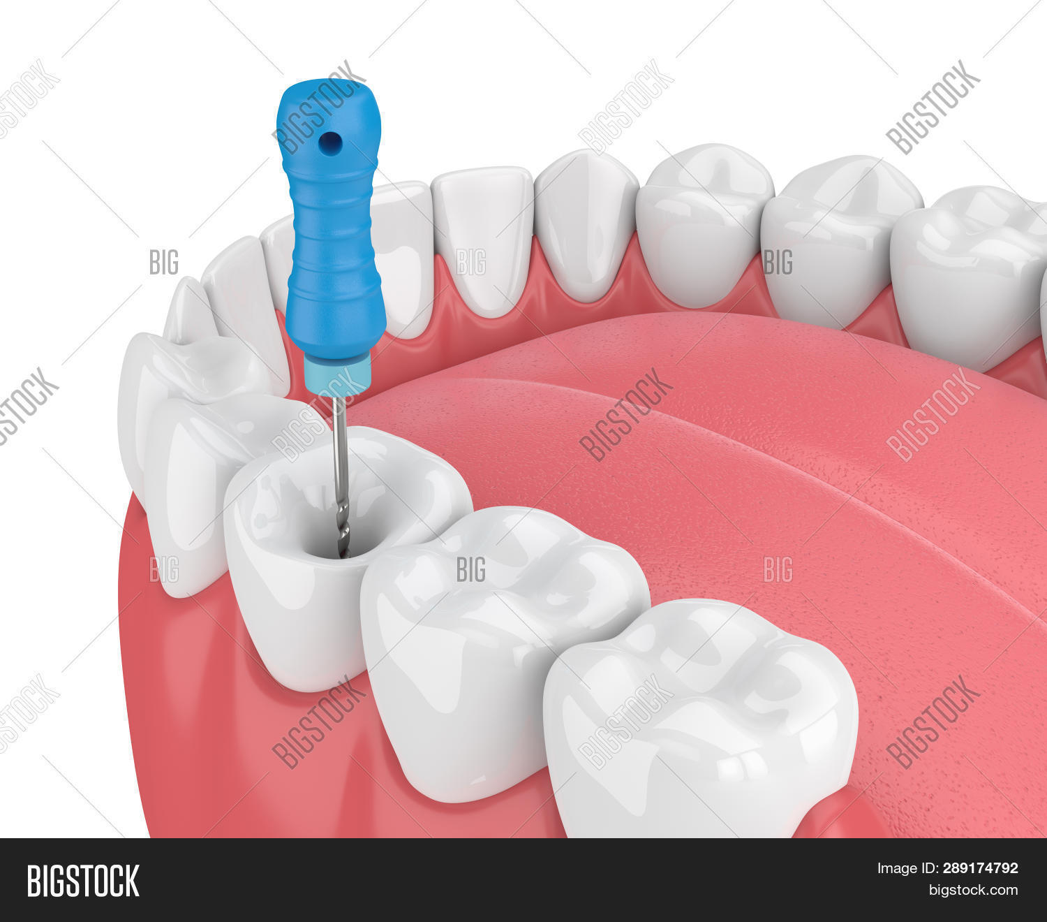 3d Render Tooth Image & Photo (Free Trial) | Bigstock