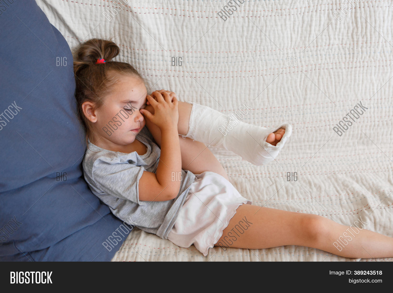 Broken Leg. Close- Image & Photo (Free Trial) | Bigstock