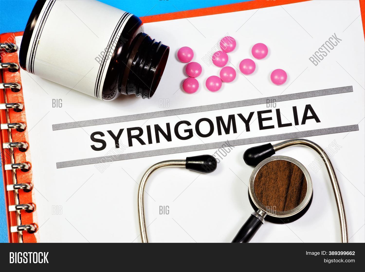 Syringomyelia Chronic Image & Photo (Free Trial) | Bigstock