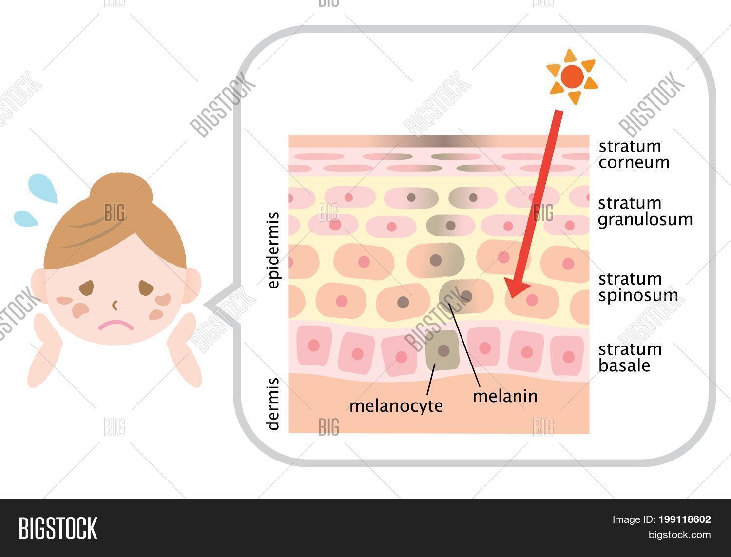 Infographic Skin Image & Photo (Free Trial) | Bigstock Infographic Skin Image & Photo (Free Trial) | Bigstock