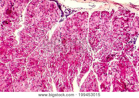 Cross-section Skeletal Image & Photo (Free Trial) | Bigstock