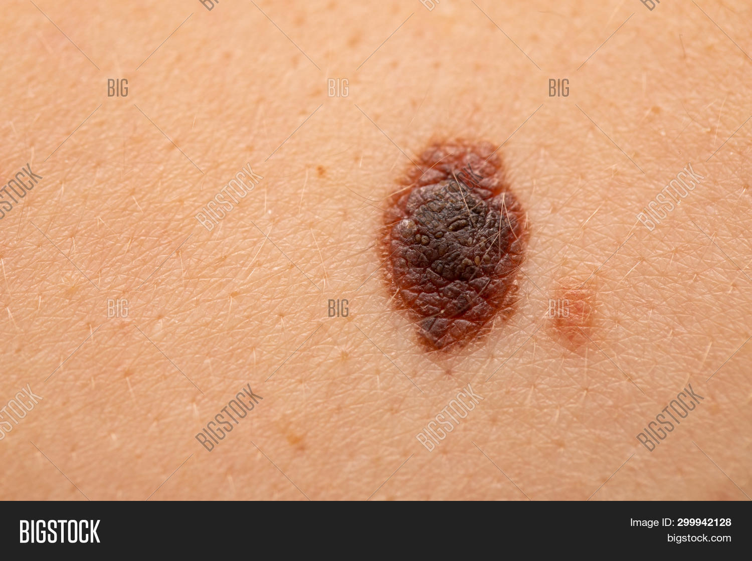 Close Picture Image & Photo (Free Trial) | Bigstock