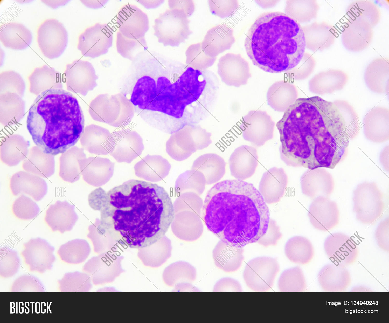 Monocyte Cell (white Blood Cell) Image & Photo | Bigstock