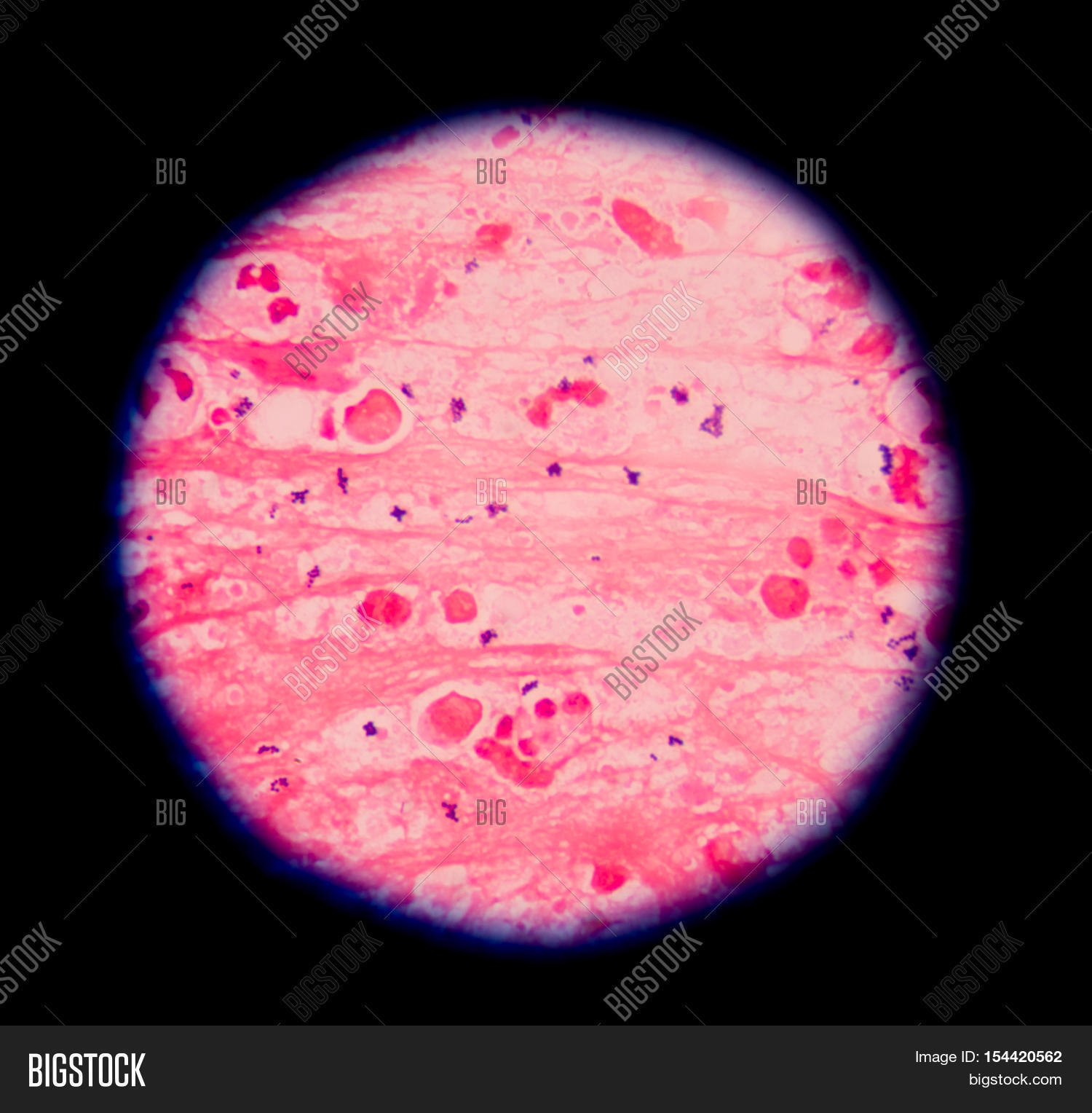 Gram Stain Showing Blue Cells Gram Image & Photo | Bigstock