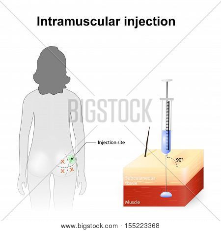 Injection Images, Stock Photos & Illustrations | Bigstock