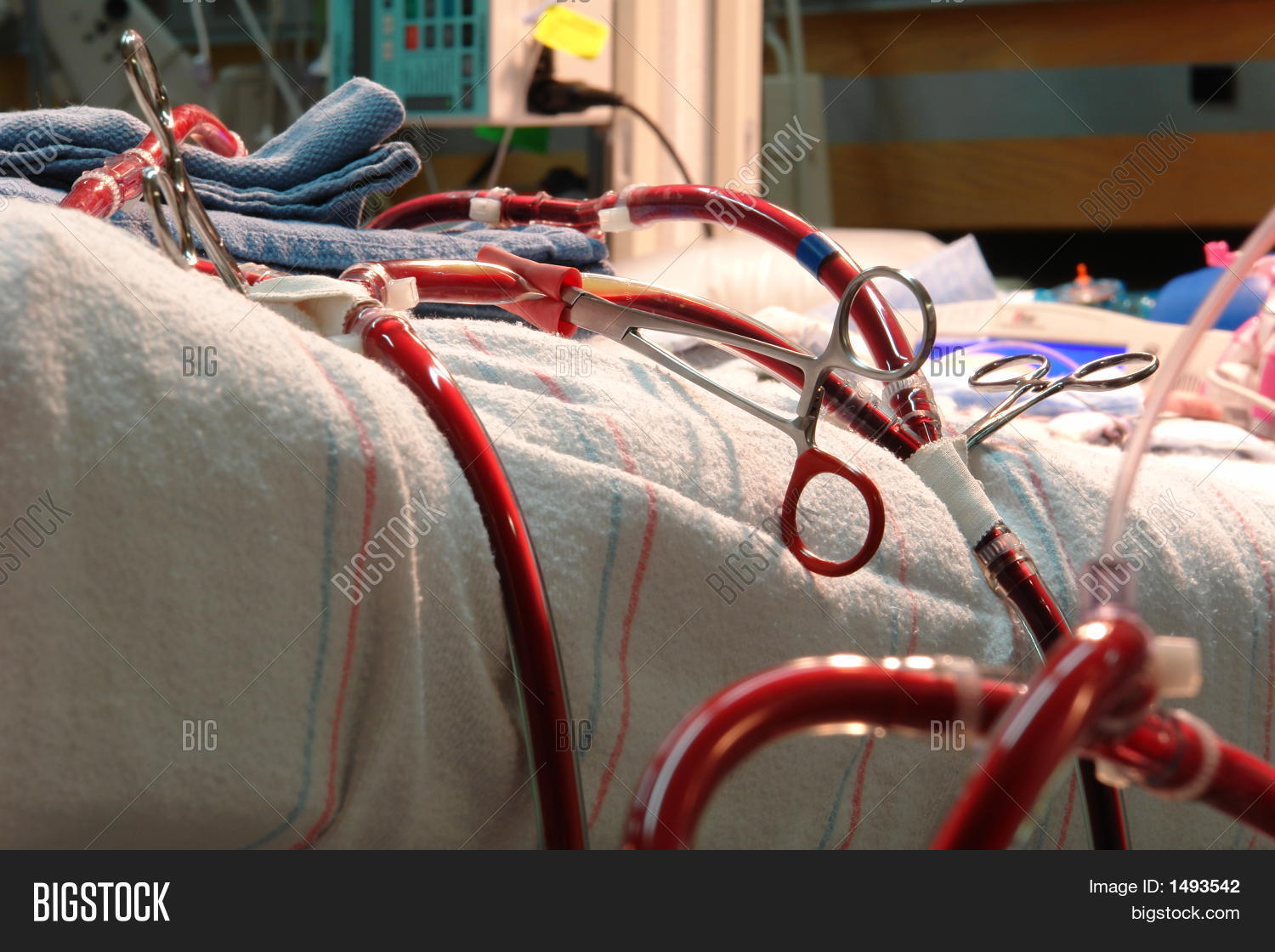 Ecmo Circuit Image & Photo | Bigstock