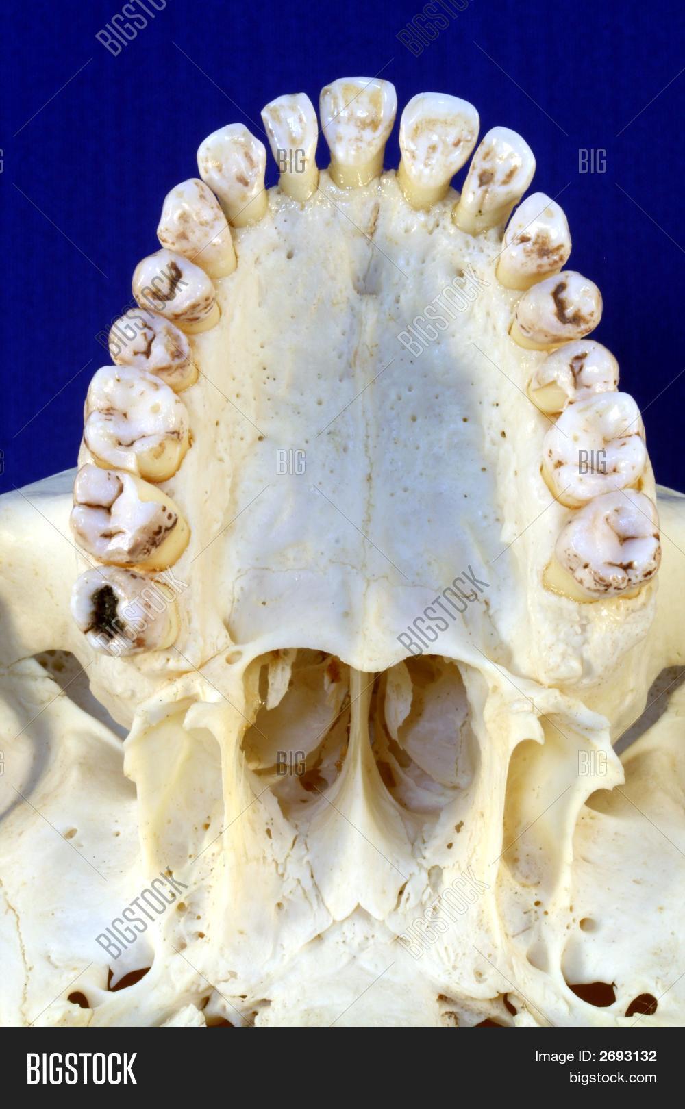 Hard Palate And Teeth Of A Human Skull Stock Photo & Stock Images ...